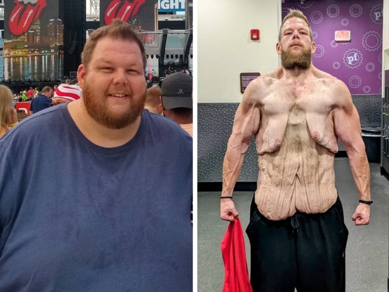 Man's Incredible 336 Pound Weight Loss Breaks the Internet with ...